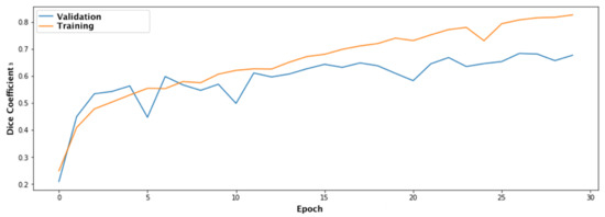Synthetic Data Generation for Steel Defect Detection and Classification Using Deep Learning