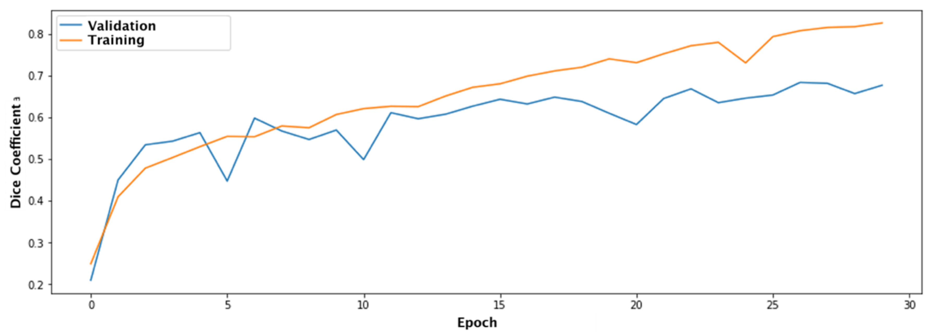 Synthetic Data Generation for Steel Defect Detection and Classification Using Deep Learning