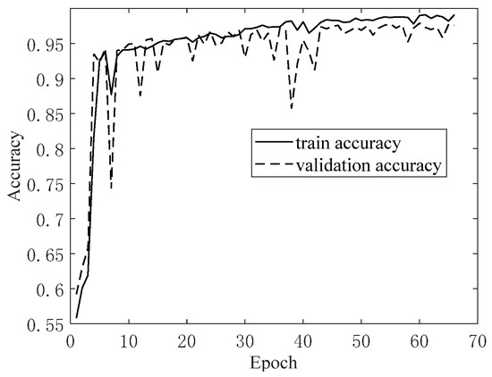 Data Anomaly Detection of Bridge Structures Using Convolutional Neural Network Based on ...