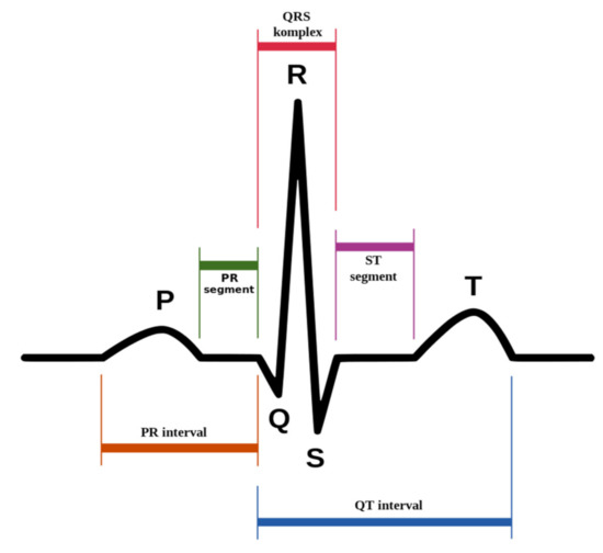 The Comparison Features of ECG Signal with Different Sampling ...