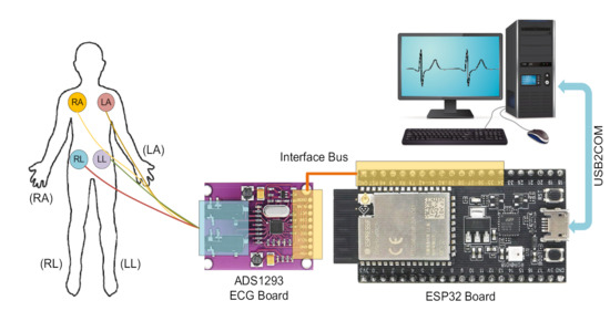 The Comparison Features of ECG Signal with Different Sampling ...