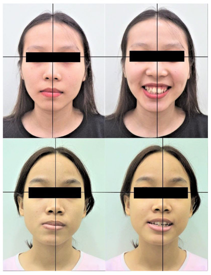 Symmetry | Free Full-Text | Acquired Facial, Maxillofacial, and Oral ...