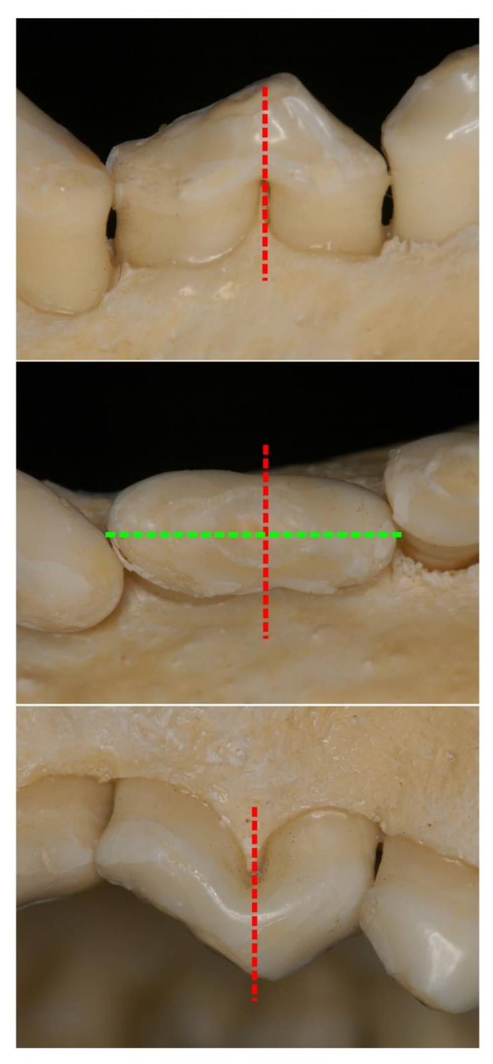 Symmetry and Aesthetics in Dentistry
