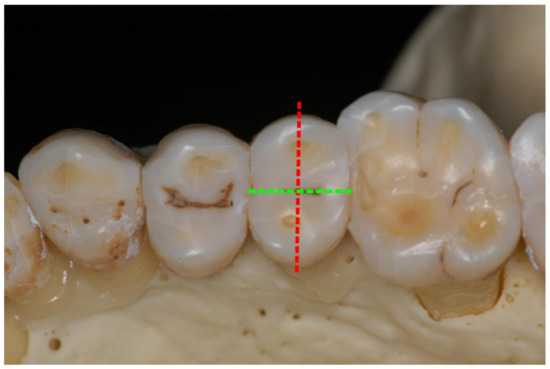 Symmetry and Aesthetics in Dentistry