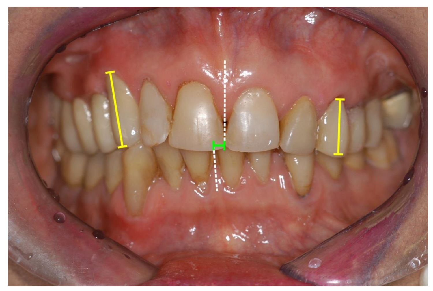 Symmetry and Aesthetics in Dentistry
