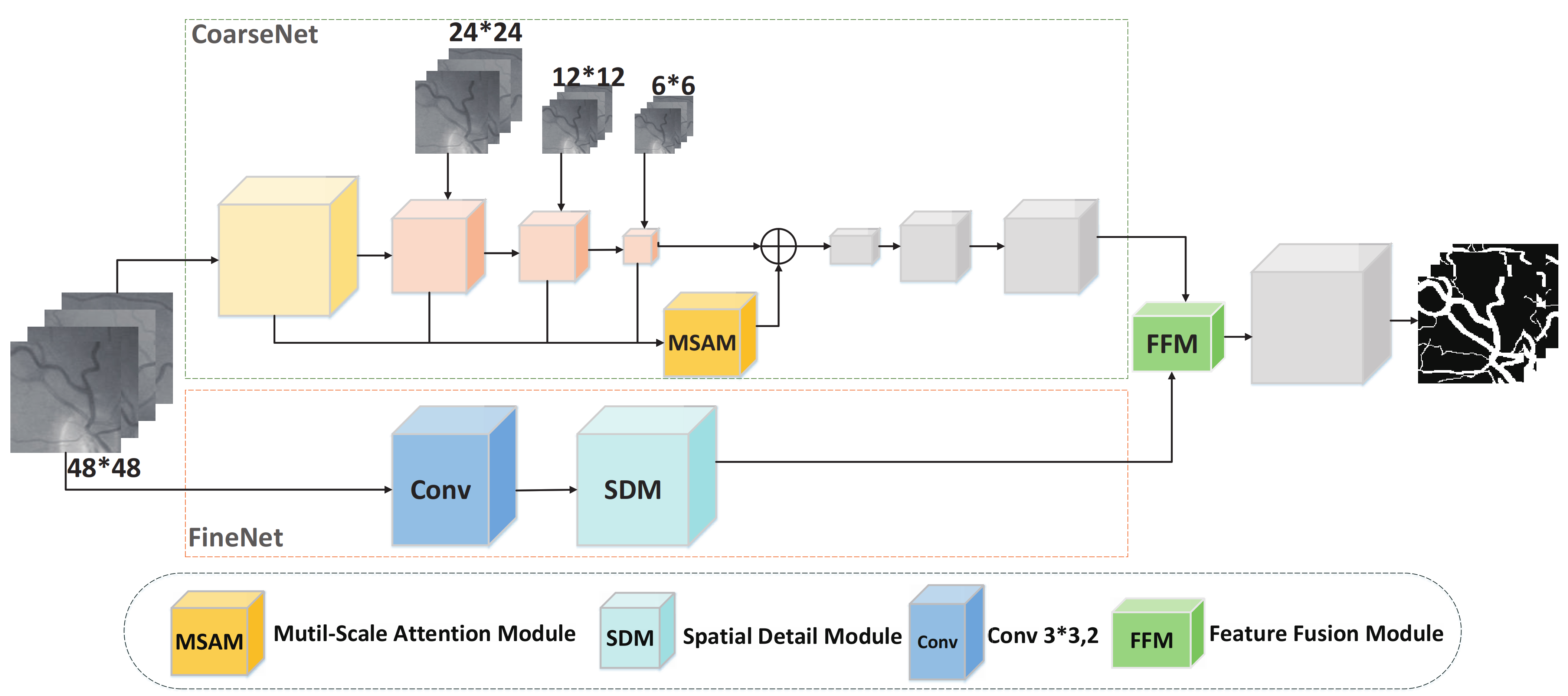 Bi-SANet—Bilateral Network with Scale Attention for Retinal Vessel Segmentation