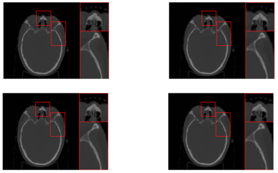 CT Image Reconstruction via Nonlocal Low-Rank Regularization and Data ...