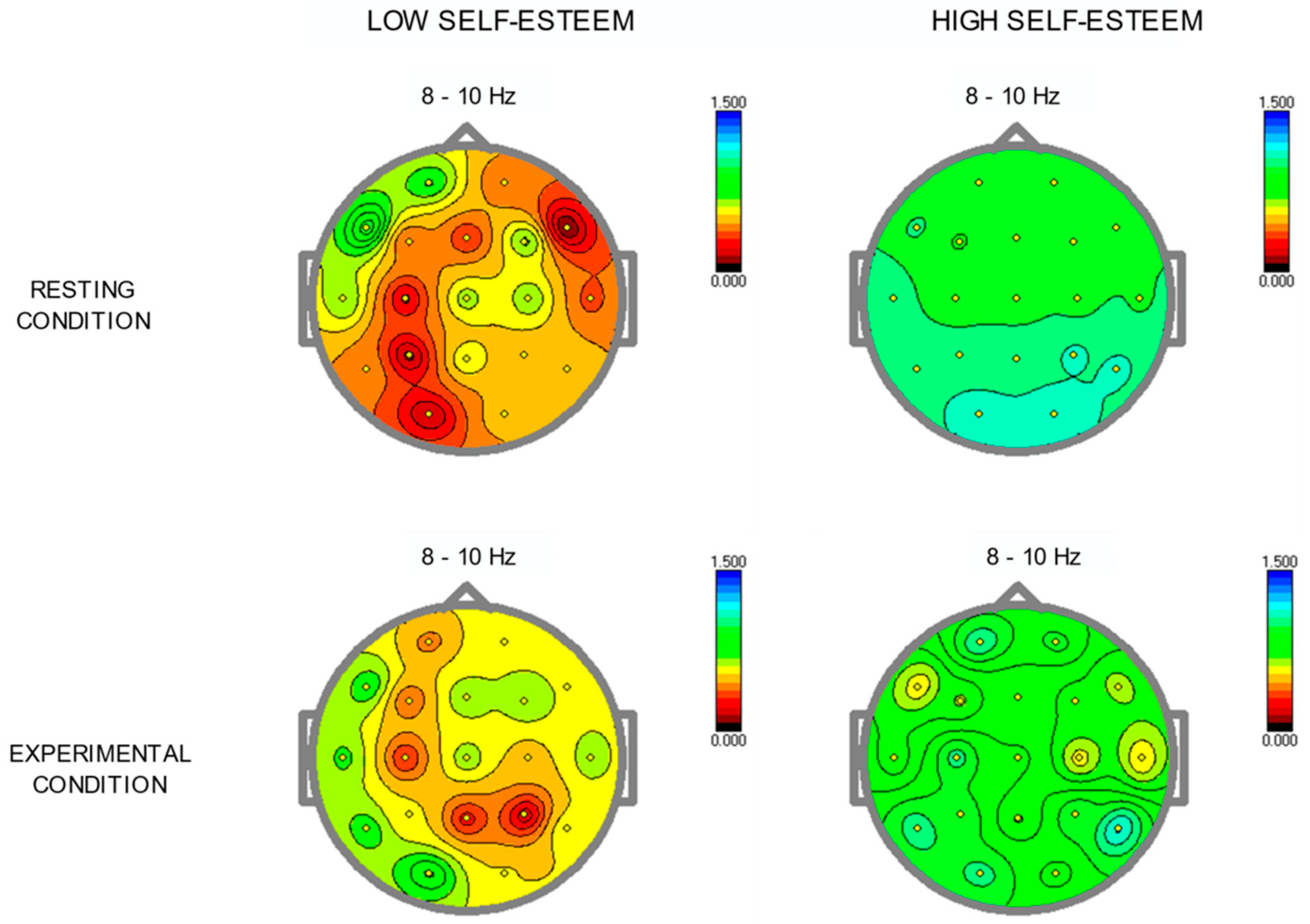 Symmetry | Free Full-Text | The Level of Self-Esteem May Influence the ...