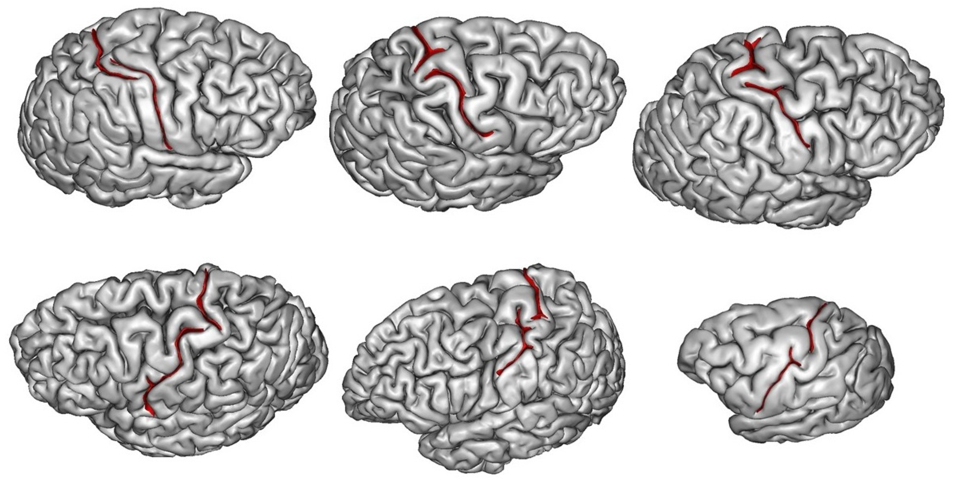 What Are the Synergies between Paleoanthropology and Brain Imaging?