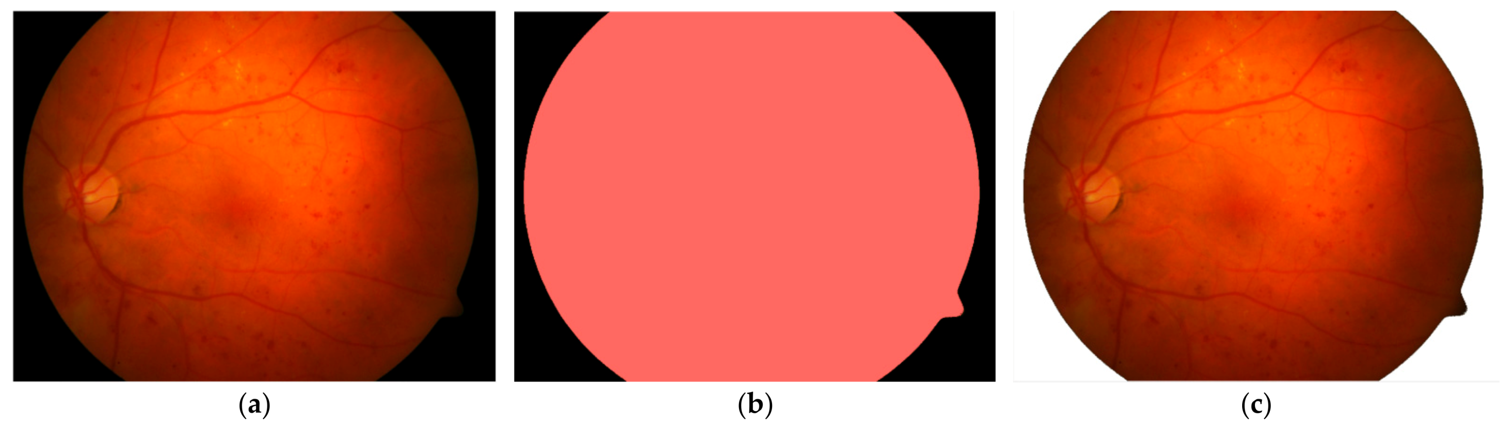 Symmetry | Free Full-Text | Enhance Contrast and Balance Color of ...