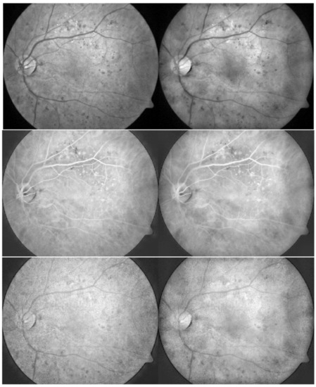 Symmetry | Free Full-Text | Enhance Contrast and Balance Color of ...