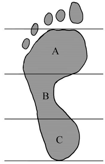 The Association between Symmetrical or Asymmetrical High-Arched Feet ...