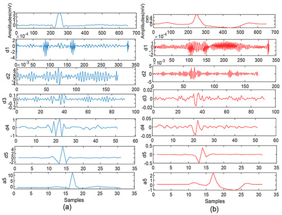 Automated Detection of Sudden Cardiac Death by Discrete Wavelet ...