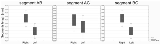 Symmetry and Asymmetry of the Antegonial Notch