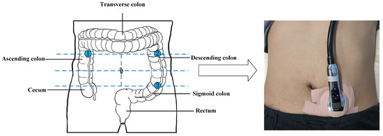 Symmetry | Free Full-Text | A Human Defecation Prediction Method Based ...
