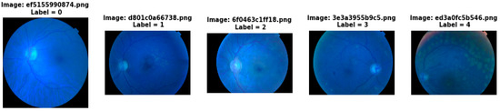 Diabetic Retinopathy Classification Using CNN and Hybrid Deep ...