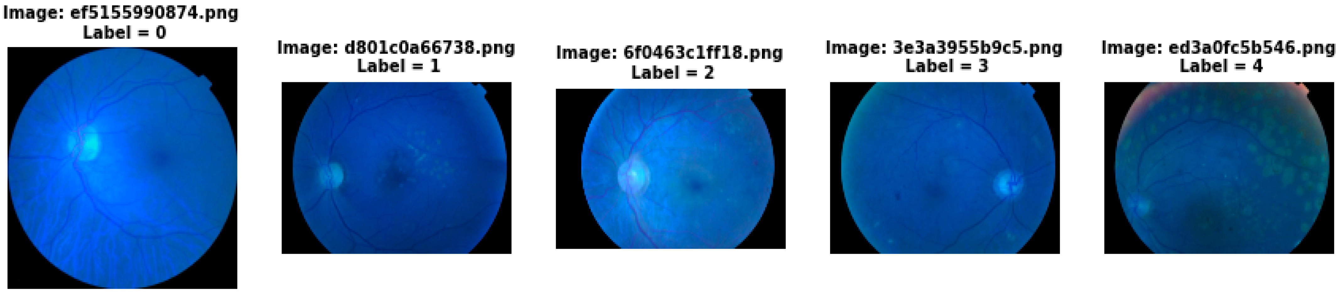 Diabetic Retinopathy Classification Using CNN and Hybrid Deep ...
