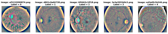Diabetic Retinopathy Classification Using CNN and Hybrid Deep ...