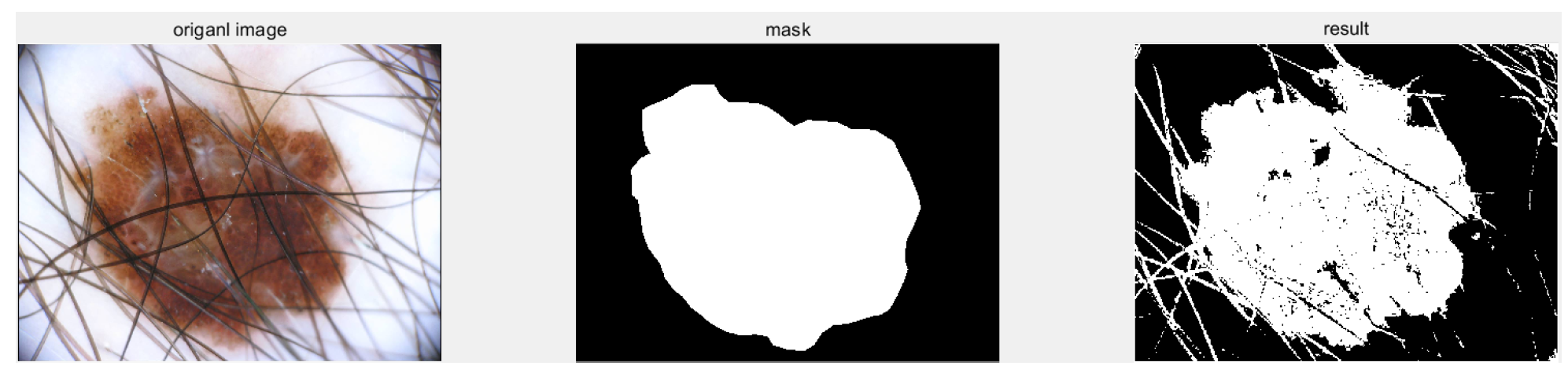 A Comparative Study of the Genetic Deep Learning Image Segmentation Algorithms
