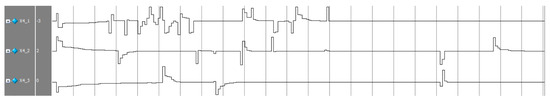 Symmetry Free Full Text Fpga Hardware Realization Of Membrane Calculation Optimization