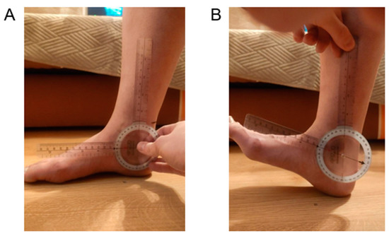 Does Mobility of the Ankle Joint Depends on Length of the Free Part of ...