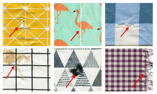 Fabric Surface Defect Detection Using SE-SSDNet