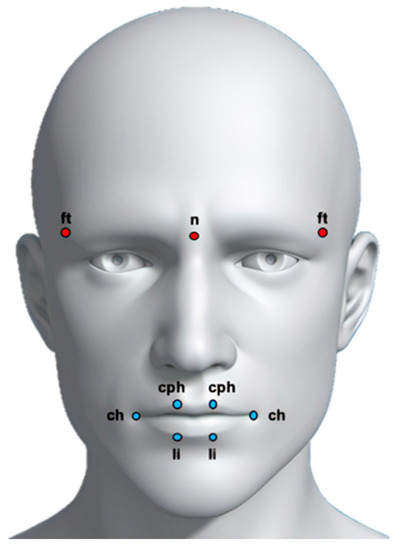 Smile Reanimation with Masseteric-to-Facial Nerve Transfer plus Cross ...