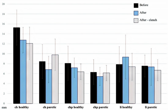 Smile Reanimation with Masseteric-to-Facial Nerve Transfer plus Cross ...