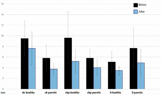 Smile Reanimation with Masseteric-to-Facial Nerve Transfer plus Cross ...