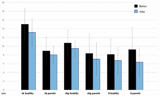 Smile Reanimation with Masseteric-to-Facial Nerve Transfer plus Cross ...