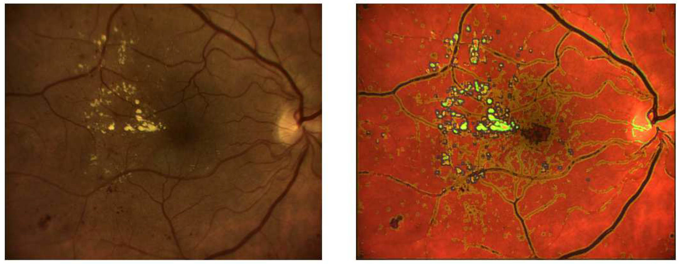 Development of a Computer System for Automatically Generating a Laser ...