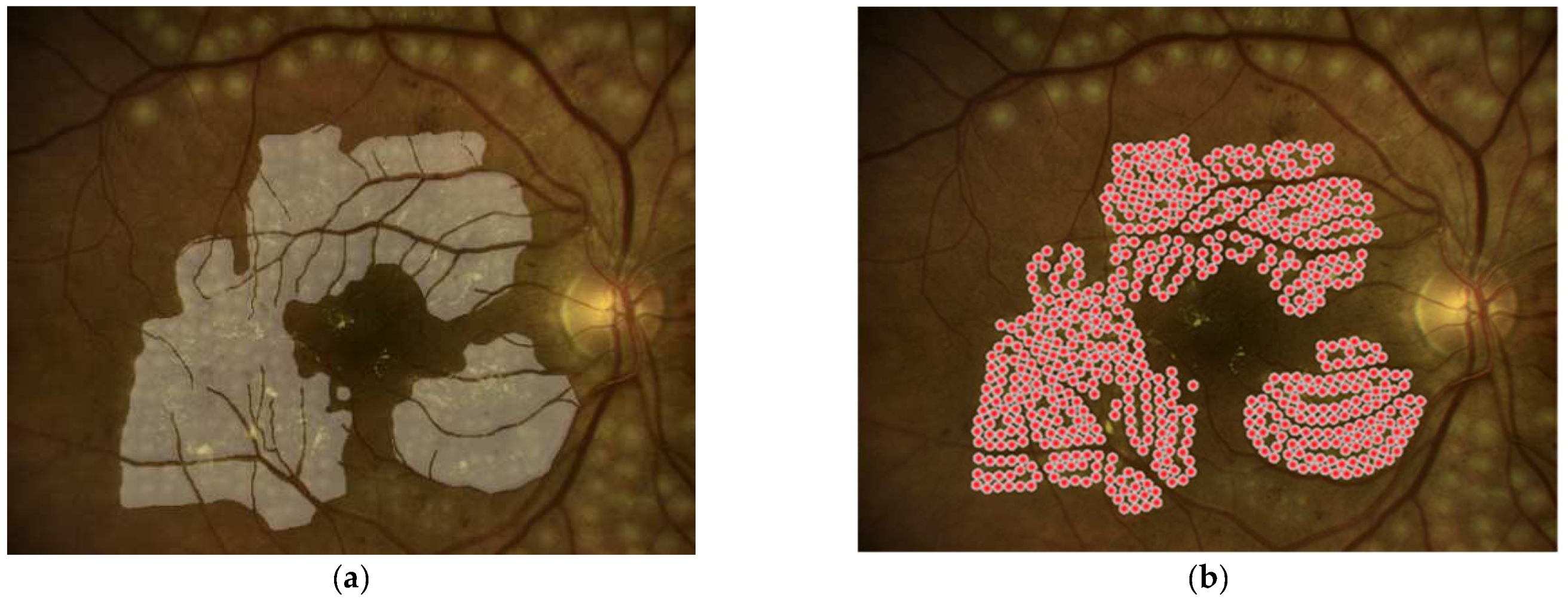 Development of a Computer System for Automatically Generating a Laser ...