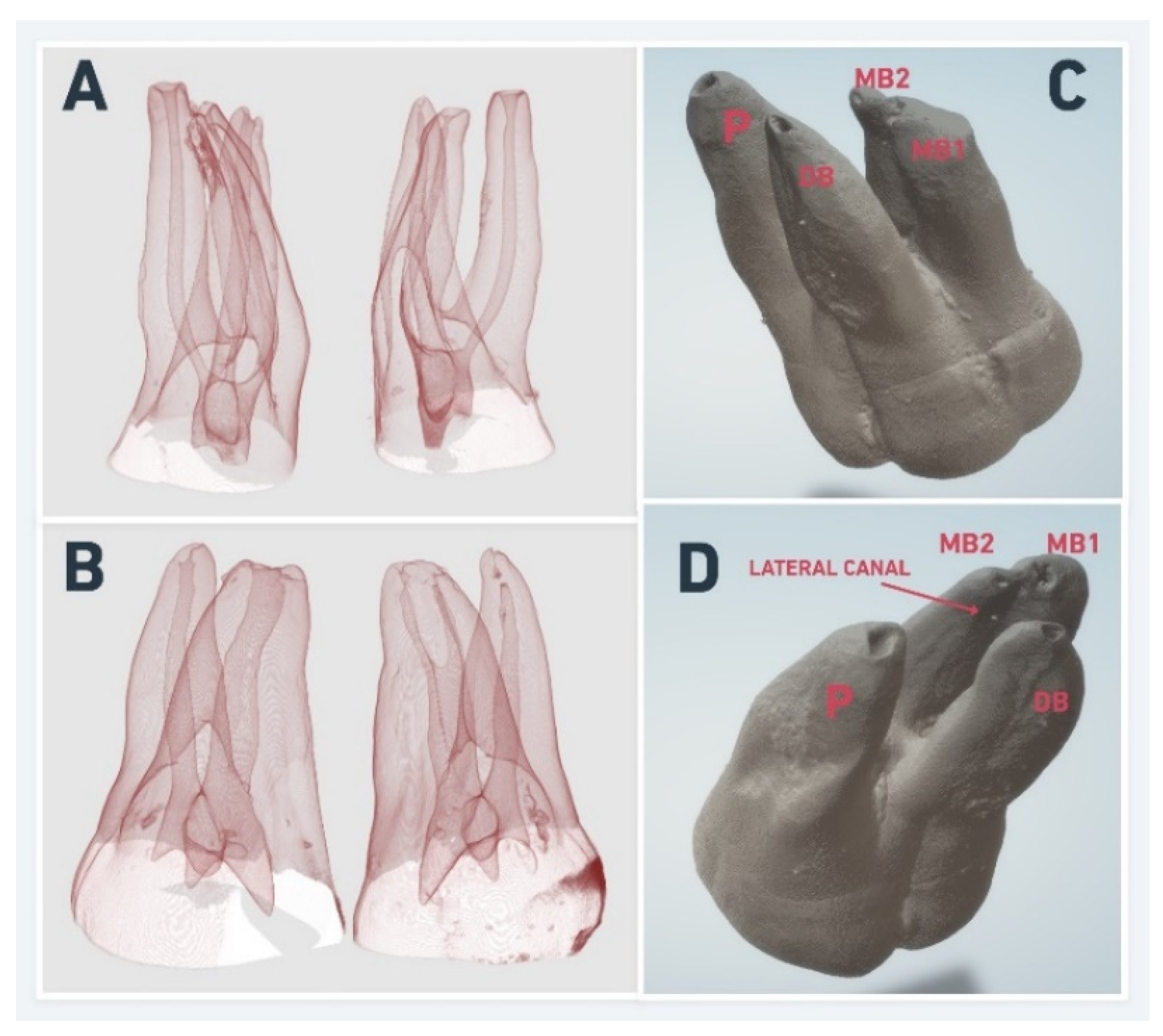 Symmetry | Free Full-Text | Anatomic Comparison of Contralateral ... Symmetry | Free Full-Text | Anatomic Comparison of Contralateral ...
