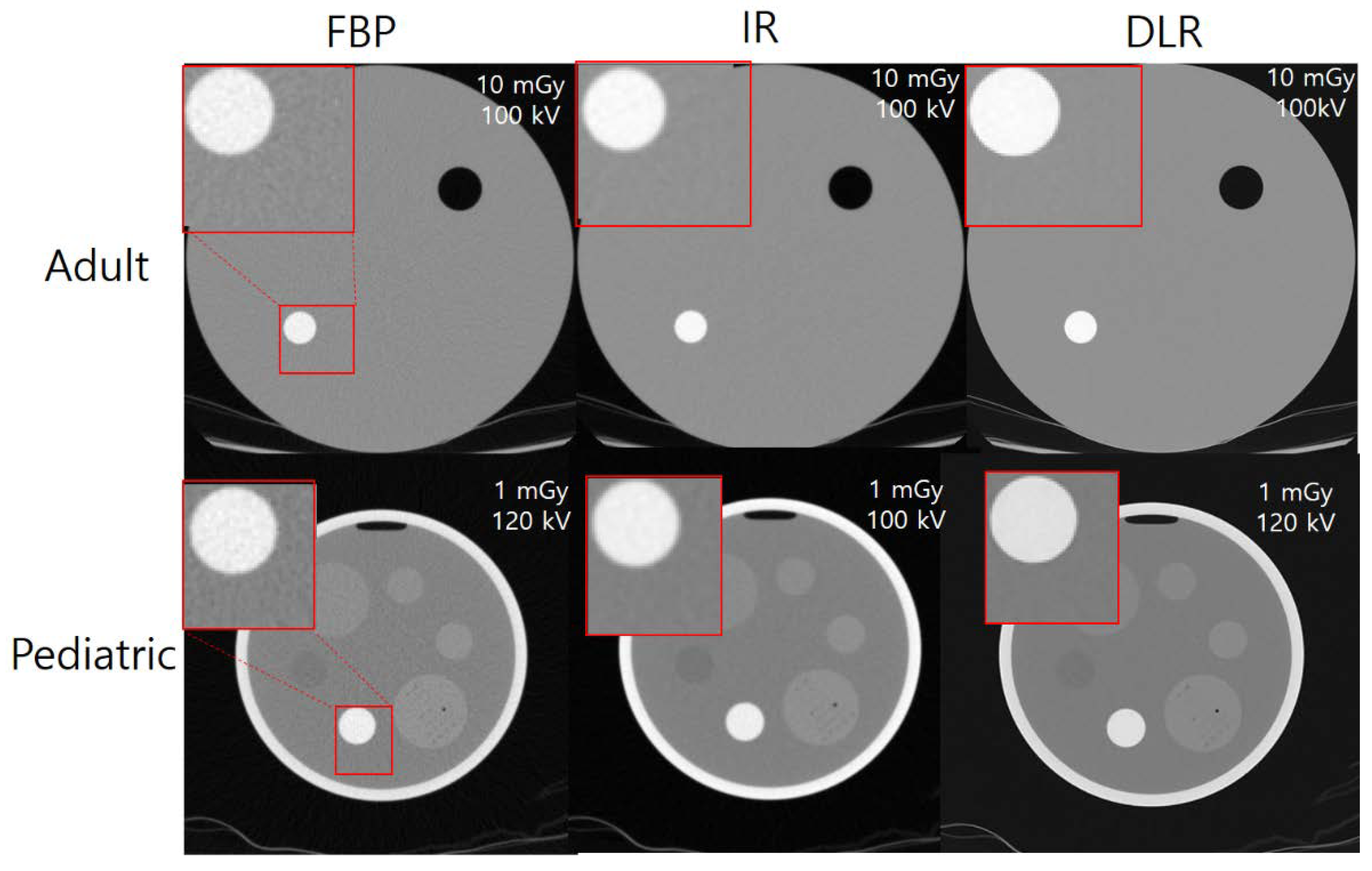 Symmetry | Free Full-Text | Effect of Tube Voltage and Radiation Dose ...