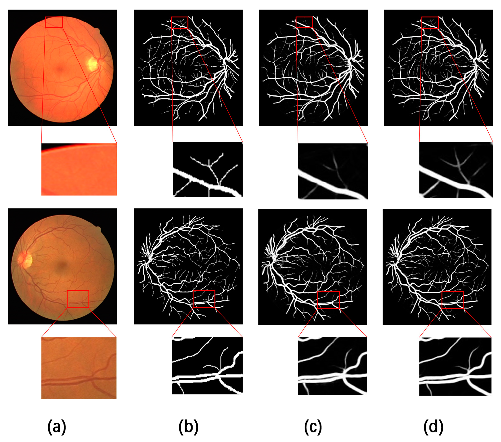 MS-CANet: Multi-Scale Subtraction Network with Coordinate Attention for Retinal Vessel Segmentation