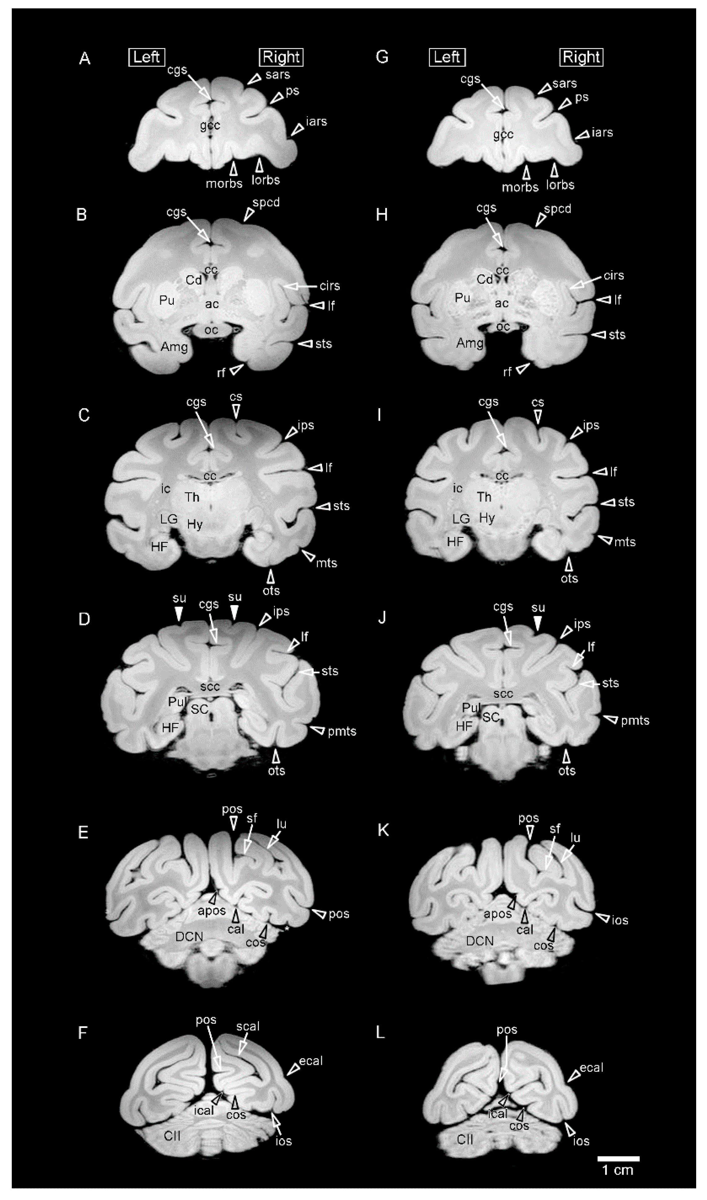 Symmetry | Free Full-Text | Sexual Dimorphic Rightward Lateralization ...