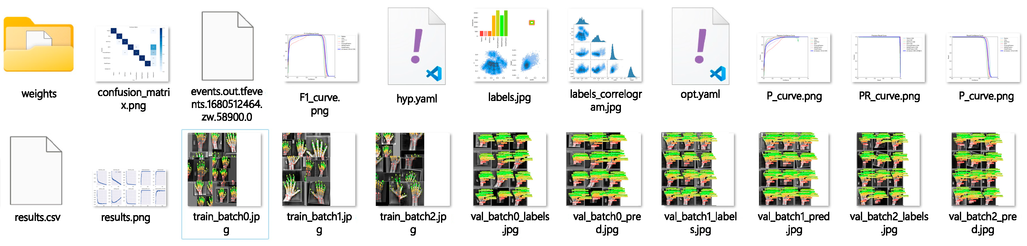 Symmetry-Based Fusion Algorithm for Bone Age Detection with YOLOv5 and ResNet34