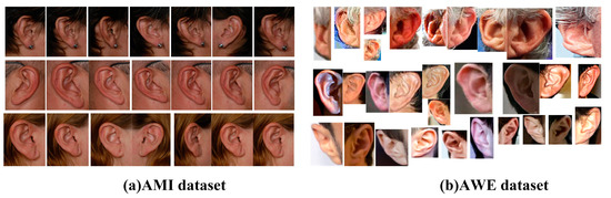 A Feature Fusion Human Ear Recognition Method Based on Channel Features and Dynamic Convolution