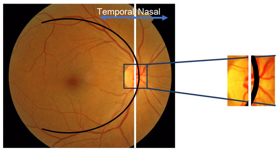 The Methods of Determining Temporal Direction Based on Asymmetric ...