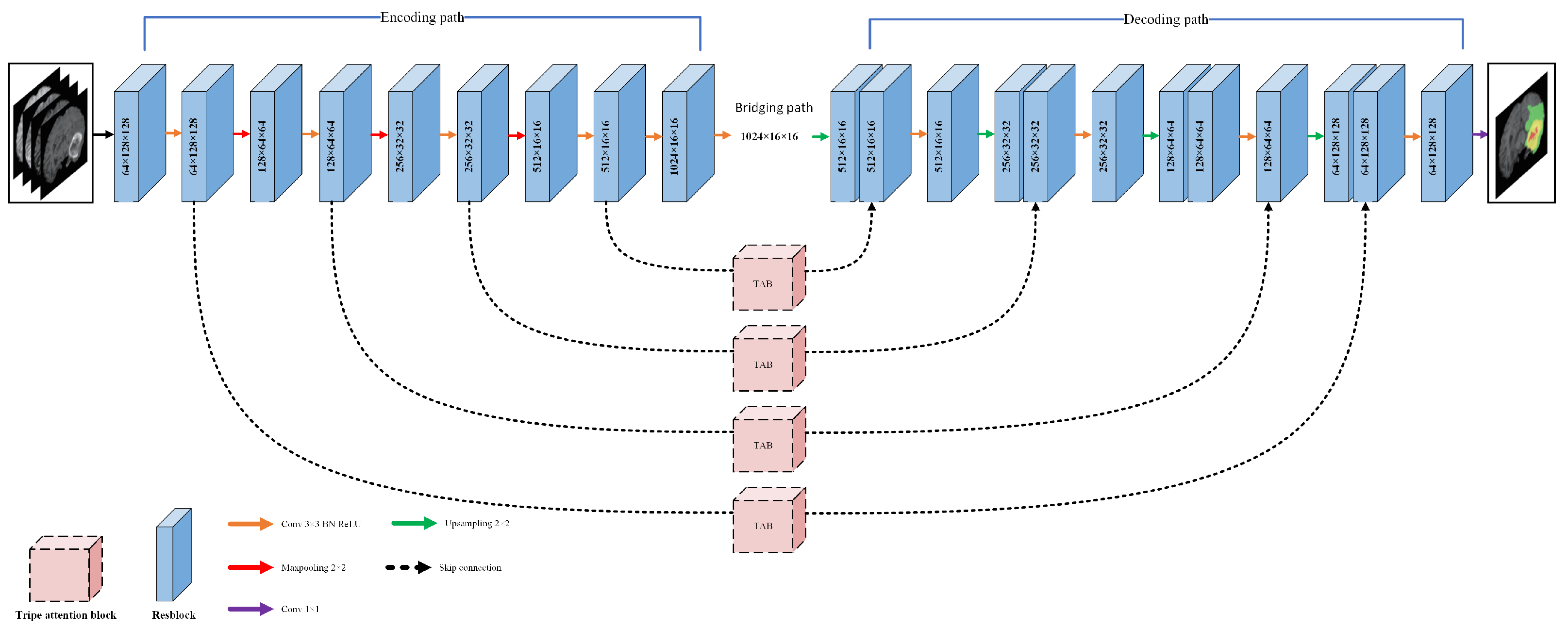 Symmetry | Free Full-Text | A Symmetrical Approach to Brain Tumor ...