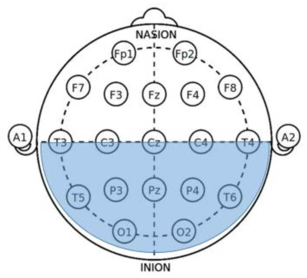 Symmetry | Free Full-Text | Unveiling the Influence of the Menstrual ...