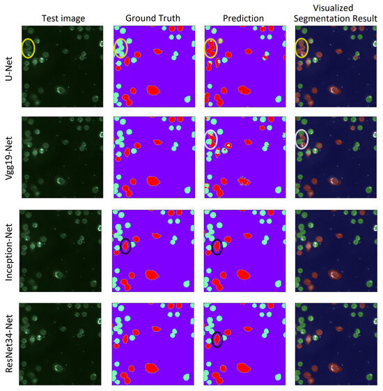 Symmetry Breaking in the U-Net: Hybrid Deep-Learning Multi-Class Segmentation of HeLa Cells in ...