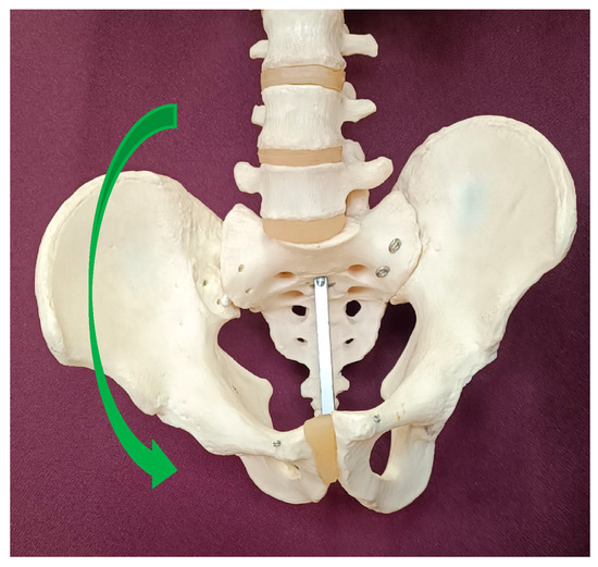 Comprehensive Analysis of Pelvic Asymmetries in Low Back Pain ...