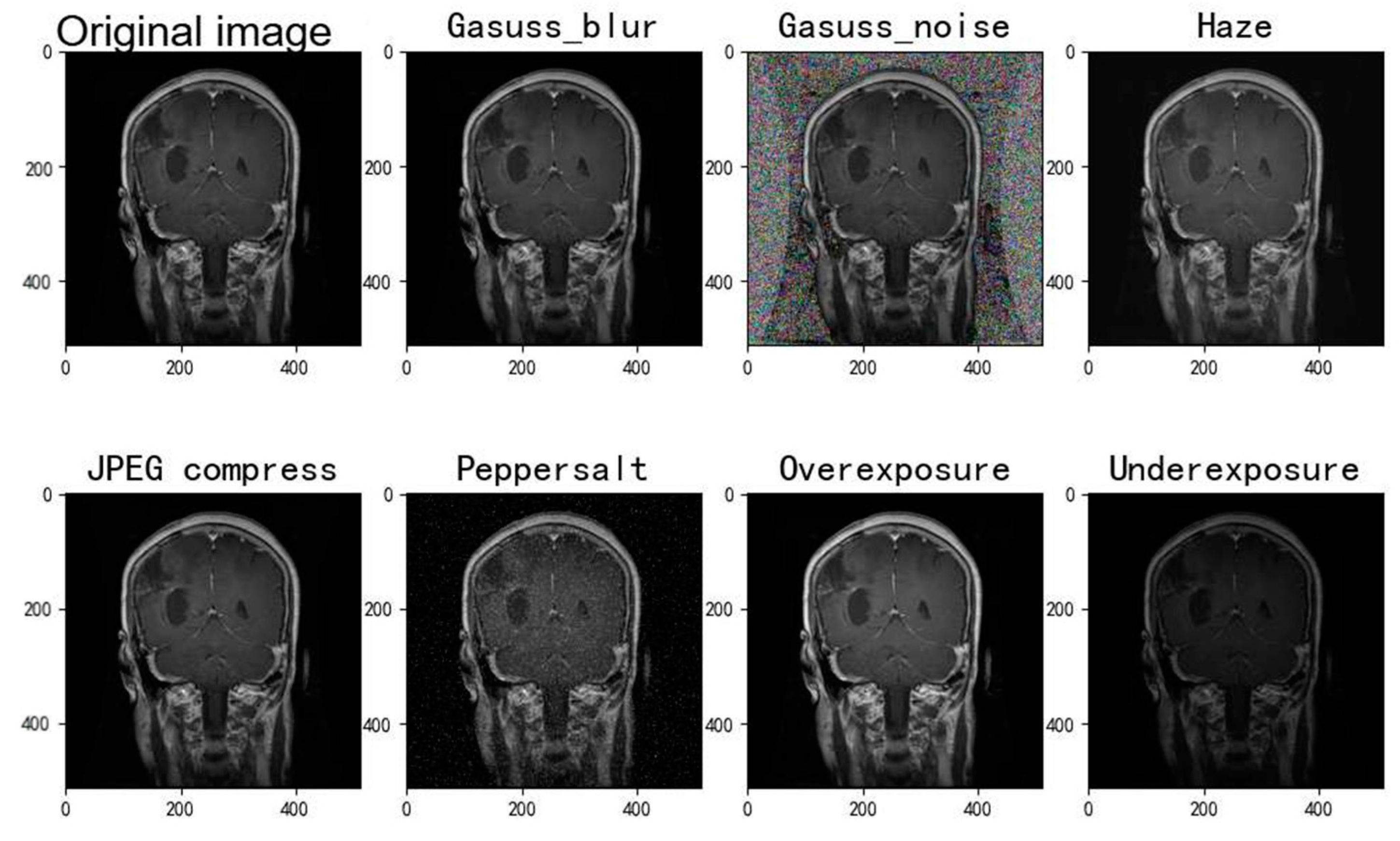 VGGNet and Attention Mechanism-Based Image Quality Assessment Algorithm in Symmetry Edge ...