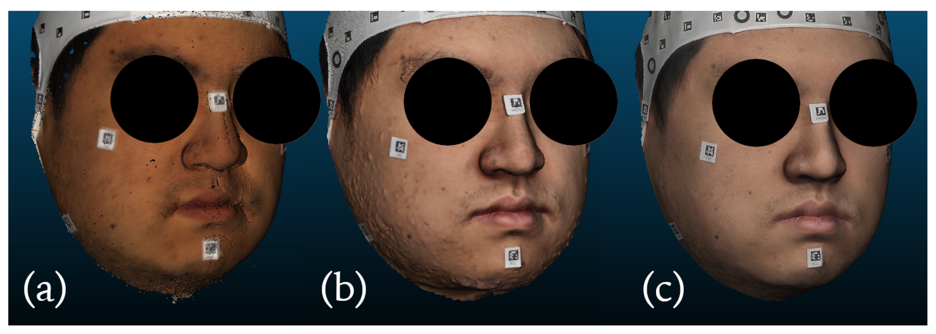 Evaluating the Accuracy of Smartphone-Based Photogrammetry and Videogrammetry in Facial ...