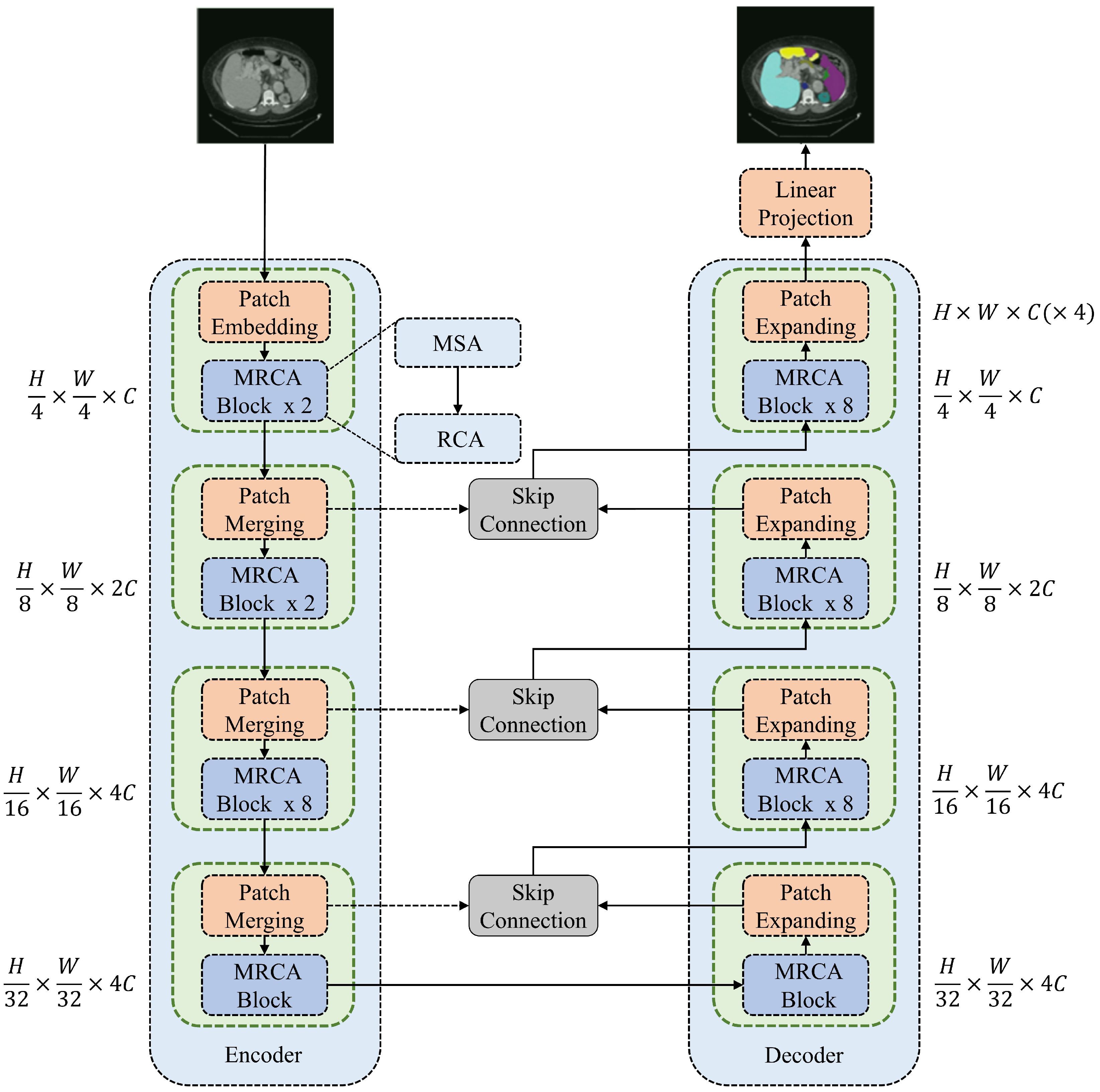 MRCA-UNet: A Multiscale Recombined Channel Attention U-Net Model for ...