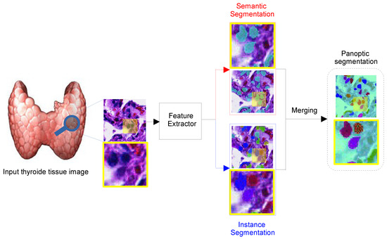 Systems | Free Full-Text | AI in Thyroid Cancer Diagnosis: Techniques ...