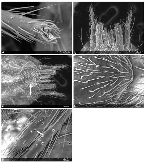First Record of the Family Hahniidae in Ecuador with Description of ...