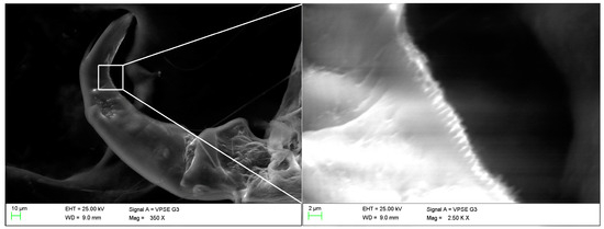 Larval Taxonomy of the Caddisfly Cernotina truncona Ross, 1947 ...