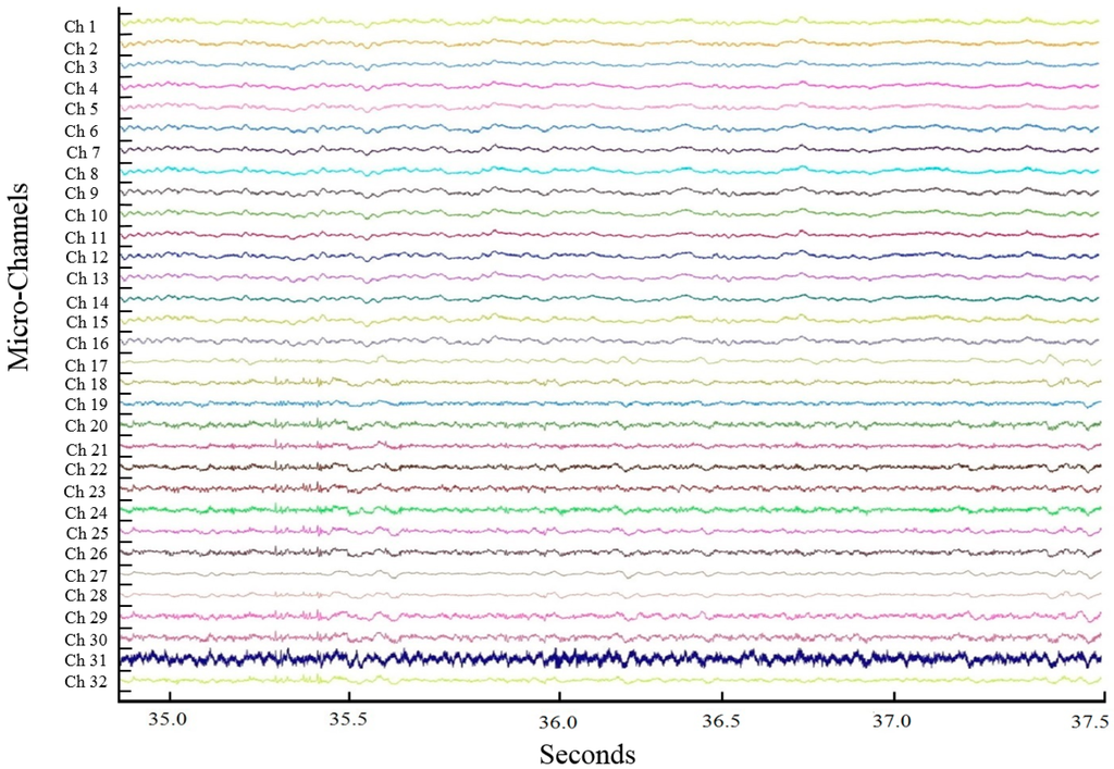 Handcrafted Electrocorticography Electrodes for a Rodent Behavioral Model